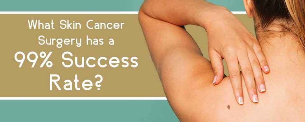 What Skin Cancer Surgery has a 99% Success Rate? | FW Dermatology